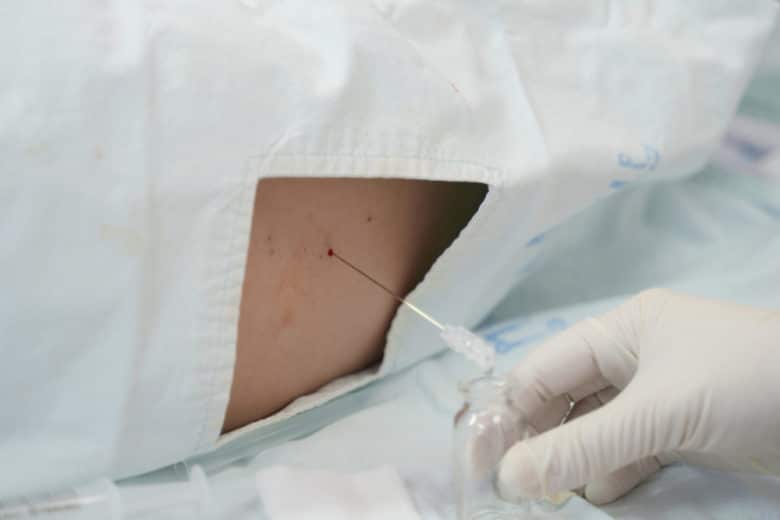 Što je lumbalna punkcija? - MZSS.hr